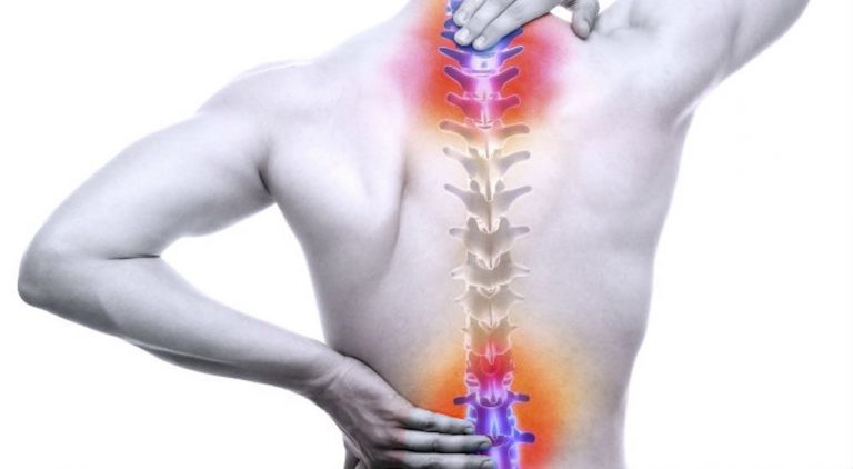 Types of Back Pain Surgery & What to Expect From it - ELMENS