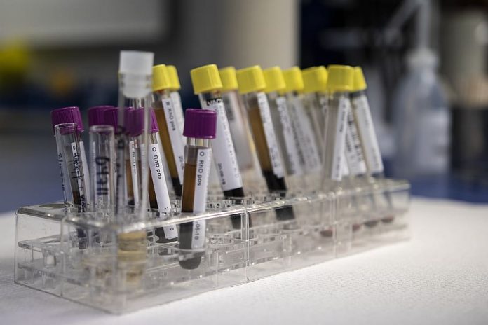 What is an ELISA and Types of ELISA Tests? - ELMENS What is an ELISA and Types of ELISA Tests? - ELMENS