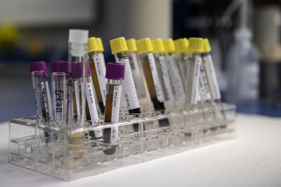 Elisa Principle And Types : The principle and method of ELISA | MBL ... Elisa Principle And Types : The principle and method of ELISA | MBL ...